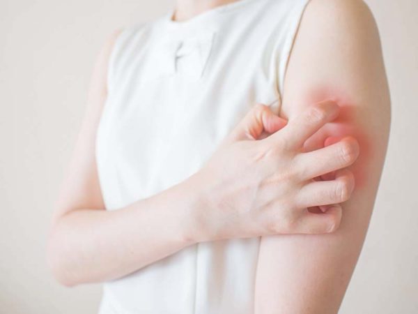 Neuro Dermatitis - Orijine - SKIN, HAIR AND WELLNESS